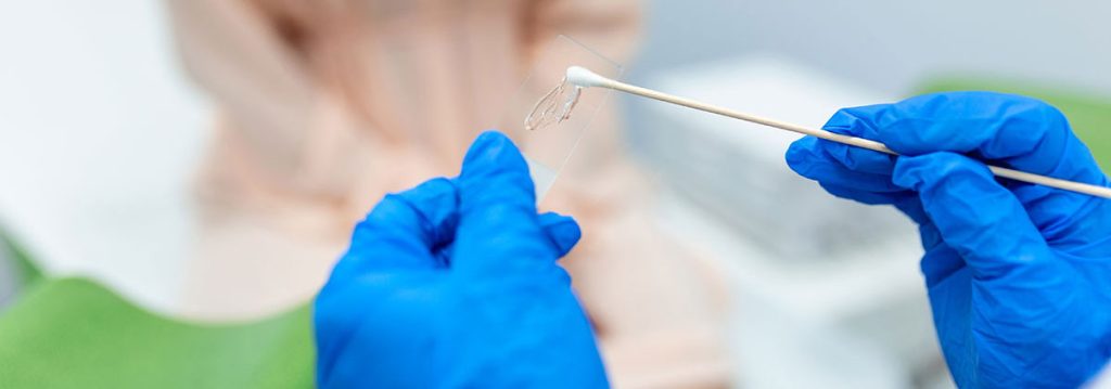 PCR GENOTIPIFICACIÓN DEL VPH - Ginecolaser